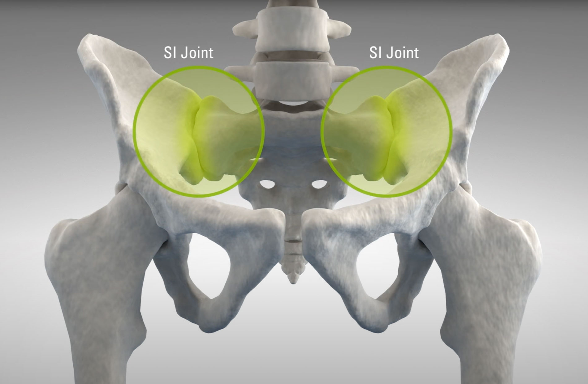 Sacroiliac Joint Fusion Santa Monica | Source Healthcare